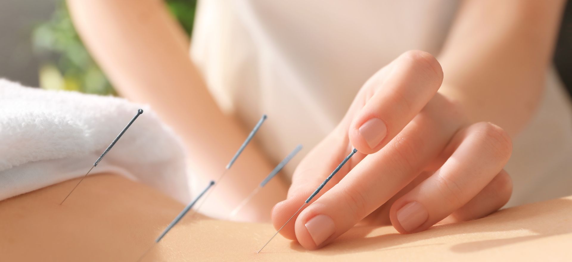 Acupuncture Penrith | The Wellness Practice